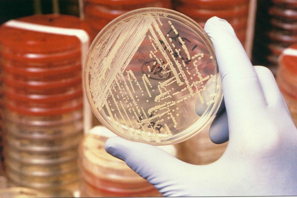 MRSA | Besmettelijke ziektes | Menselijk Lichaam - Menselijk Lichaam