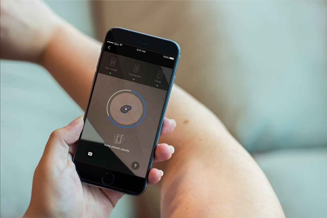 Controleer je huid op huidkanker met de app SkinVision - Menselijk Lichaam