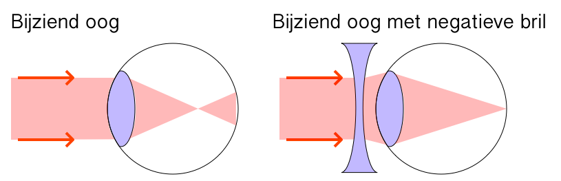 Bijziend | Het oog | Menselijk Lichaam - Menselijk Lichaam