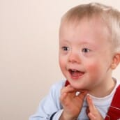 Geestelijk gehandicapten | Algemeen | Menselijk Lichaam - Menselijk Lichaam