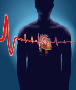 Hartinfarct | Algemeen | Menselijk Lichaam - Menselijk Lichaam