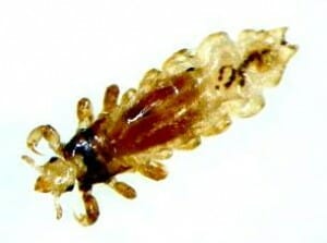 Luizen | Huid | Menselijk Lichaam - Menselijk Lichaam