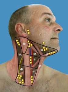 Lymfeklier ziekte | Veel voorkomende ziekten | Menselijk Lichaam ...