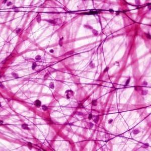 bindweefsels | Algemeen | Menselijk Lichaam - Menselijk Lichaam