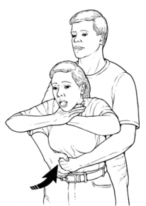 Hoe werkt de heimlich handgreep? | Eerste hulp - EHBO | Menselijk ...